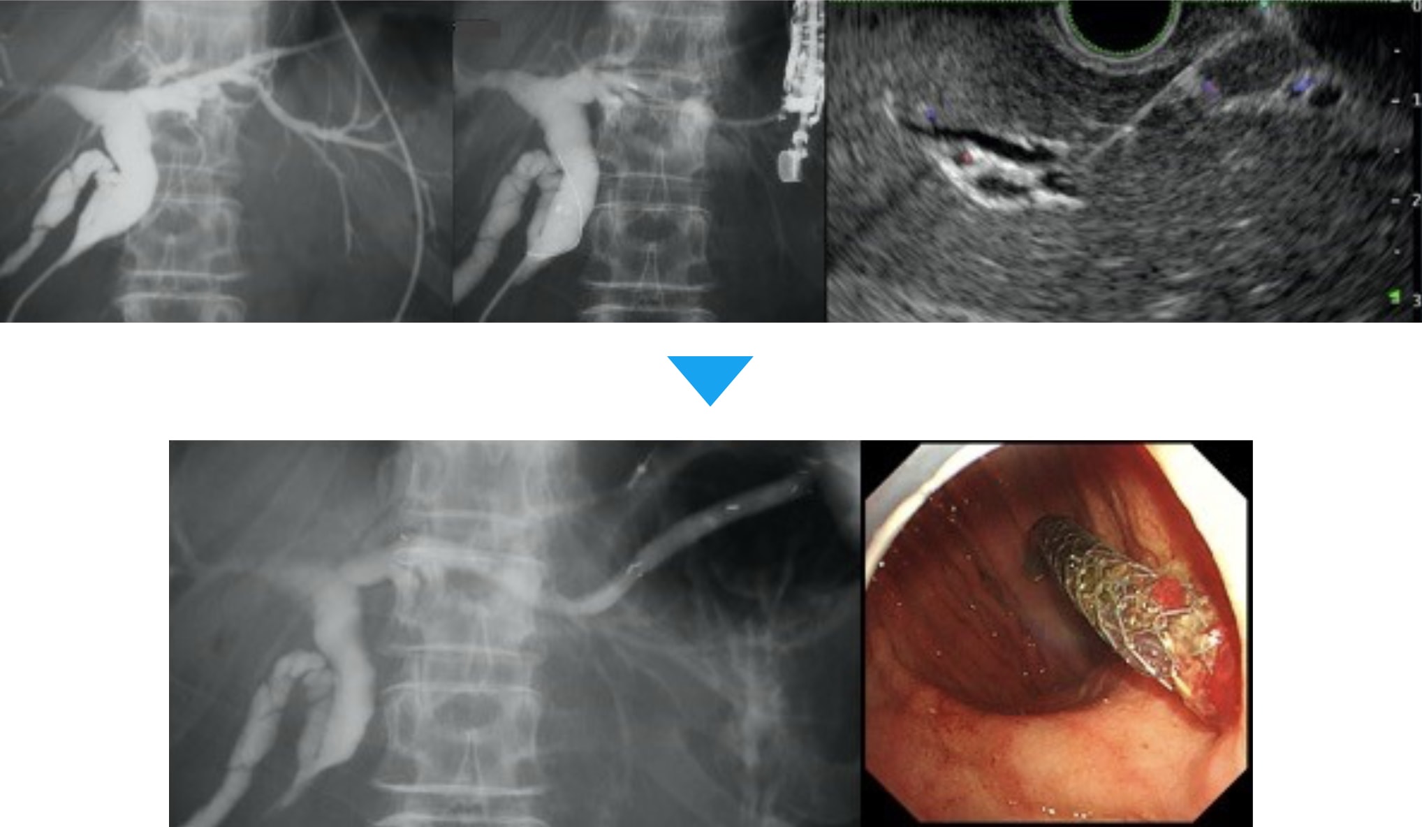 胆膵グループ - 医大第二内科